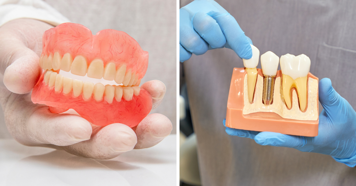 Dental Implants vs. Dentures: Best Options in White Rock, BC